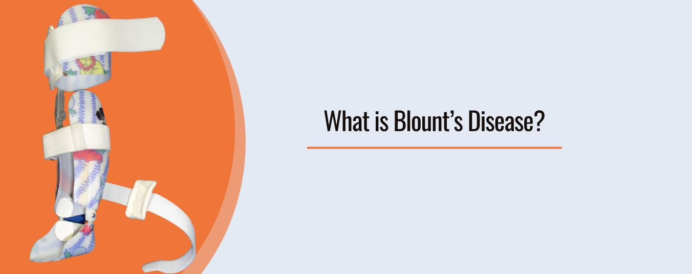 what is blounts disease - Xtremity Blogs