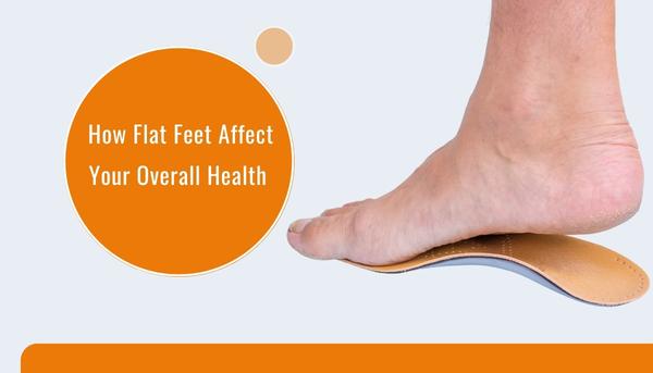 How Flat Feet Affect Your Overall Health - Xtremity - Mobility & Beyond